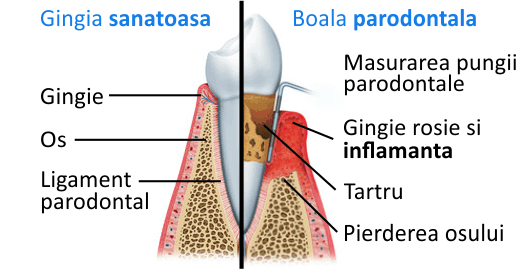 Laser Dentistry Cluj | Cabinet Stomatologie asistata Laser | Dr. Mirela ...