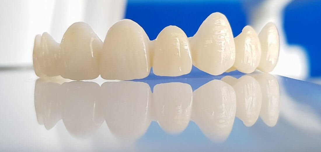 Laser Dentistry Cluj | Cabinet Stomatologie asistata Laser | Dr. Mirela ...